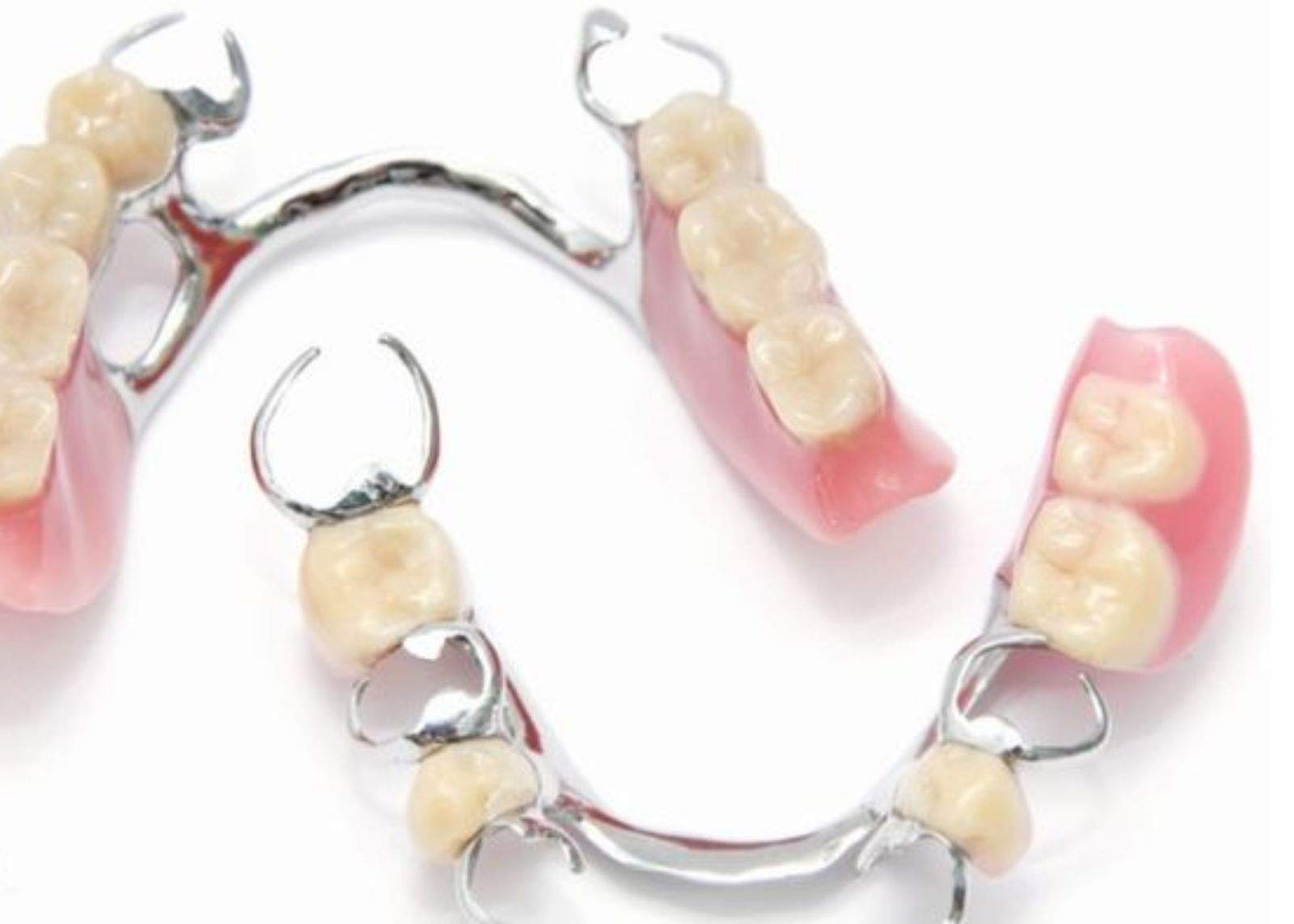 Prótese dentária removível: tipos, modelos e indicações – Dental Center ...